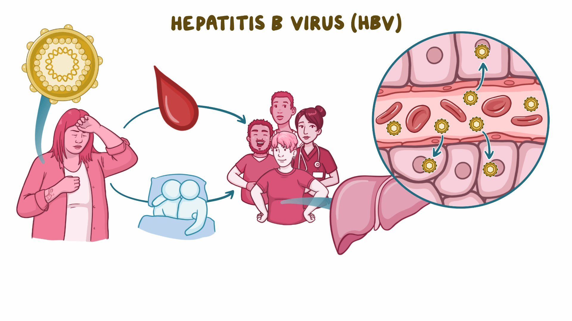 Video: Hepatitis B: Clinical sciences | Osmosis
