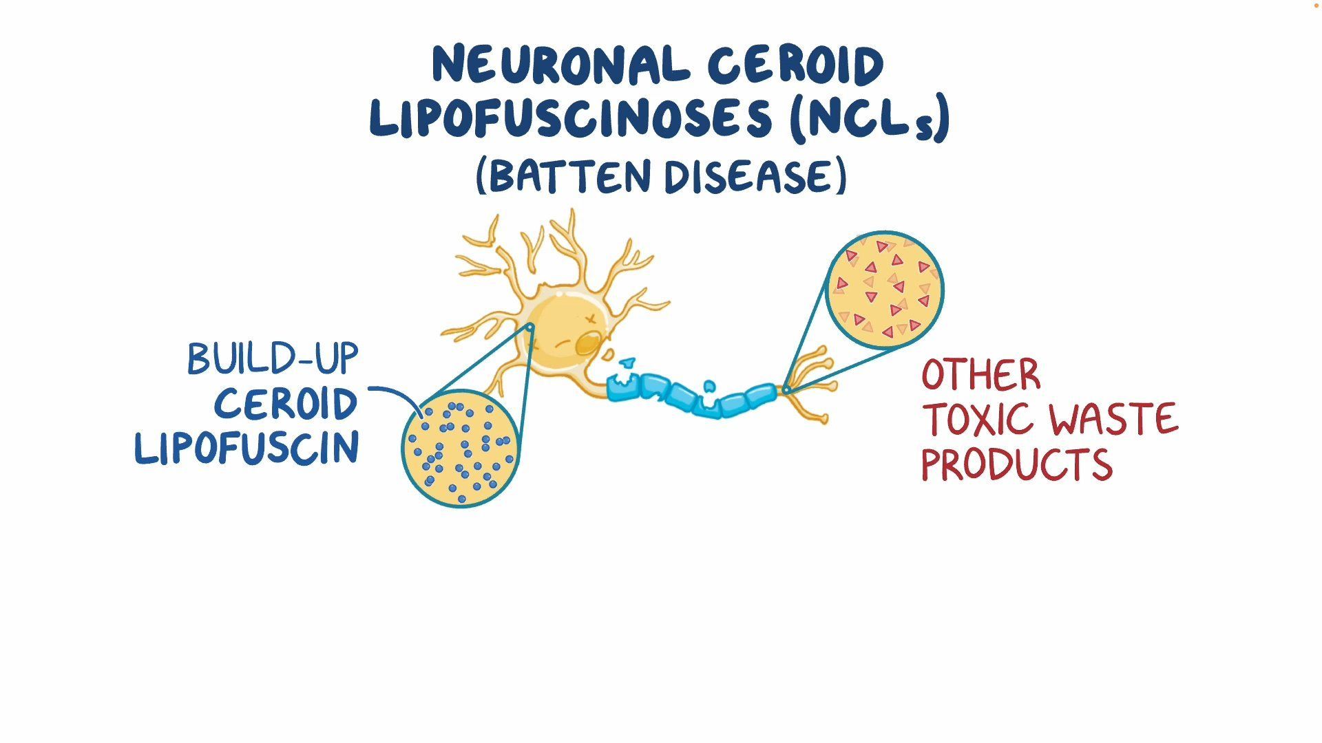 Video: Neuronal ceroid lipofuscinoses (Batten disease): Year of the ...