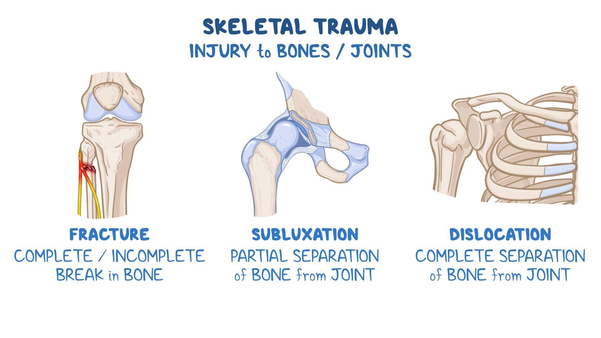 Video Skeletal Trauma Osmosis Video Skeletal Trauma Osmosis