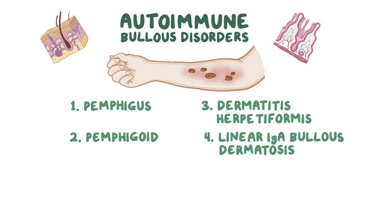 Video: Autoimmune bullous skin disorders: Clinical | Osmosis