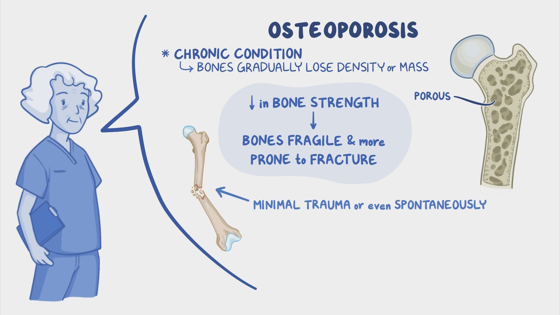 Video: Osteoporosis: Nursing | Osmosis