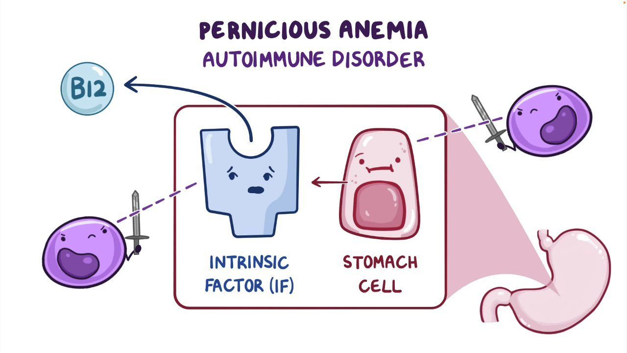 Pernicious Anaemia Mechanism