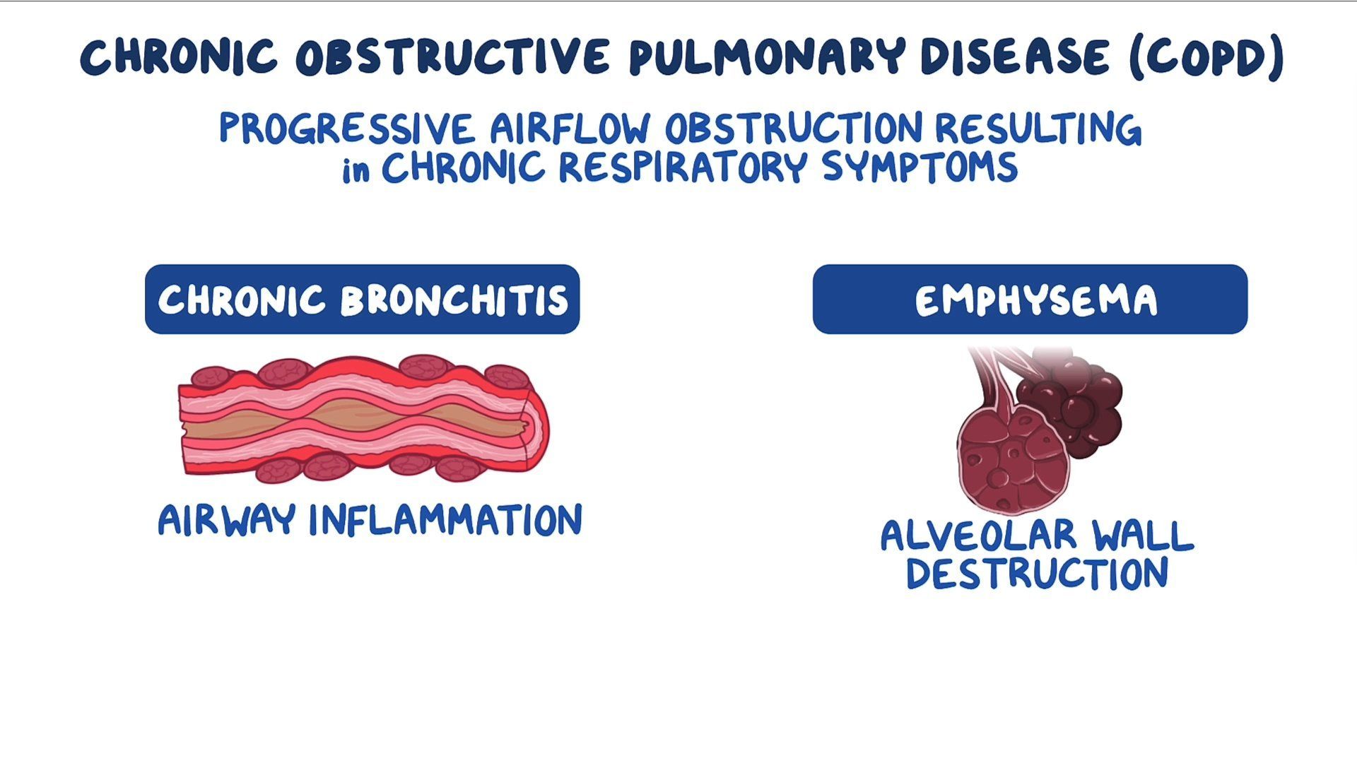 Video: Chronic obstructive pulmonary disease: Clinical sciences | Osmosis