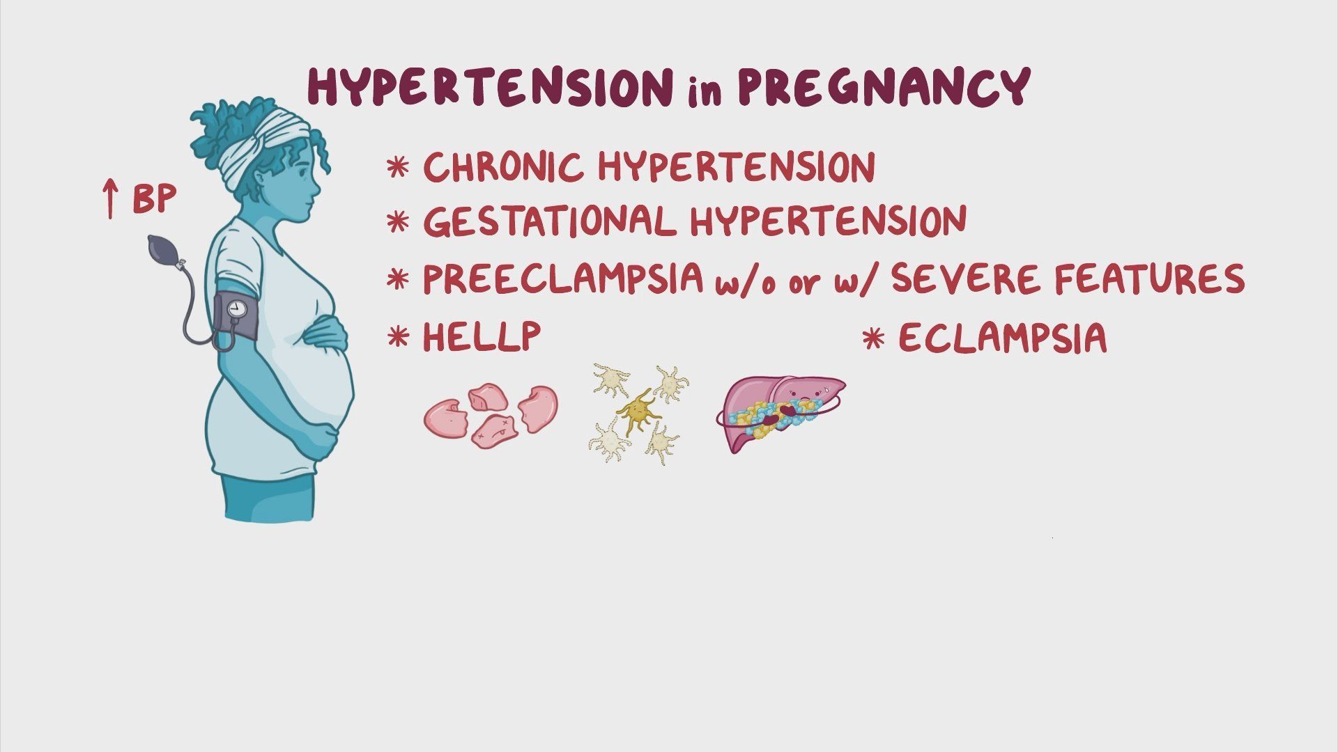 Video: Approach to hypertensive disorders in pregnancy: Clinical ...