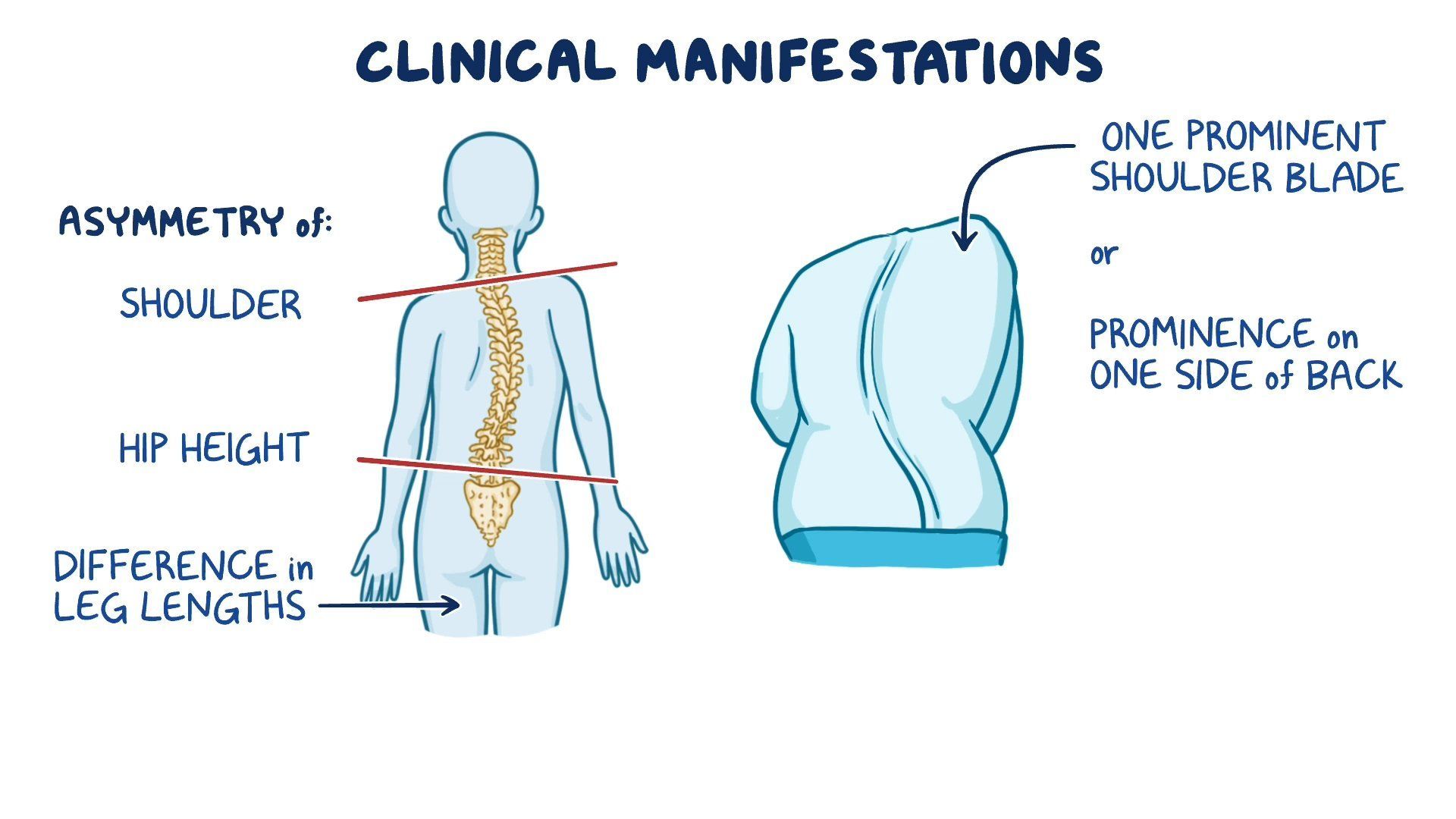 Video: Skeletal Disorders and Immobilization in the Pediatric Patient ...