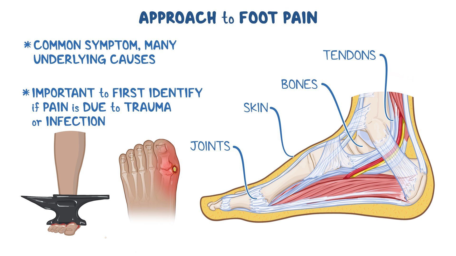 Video: Approach to foot pain: Clinical sciences | Osmosis