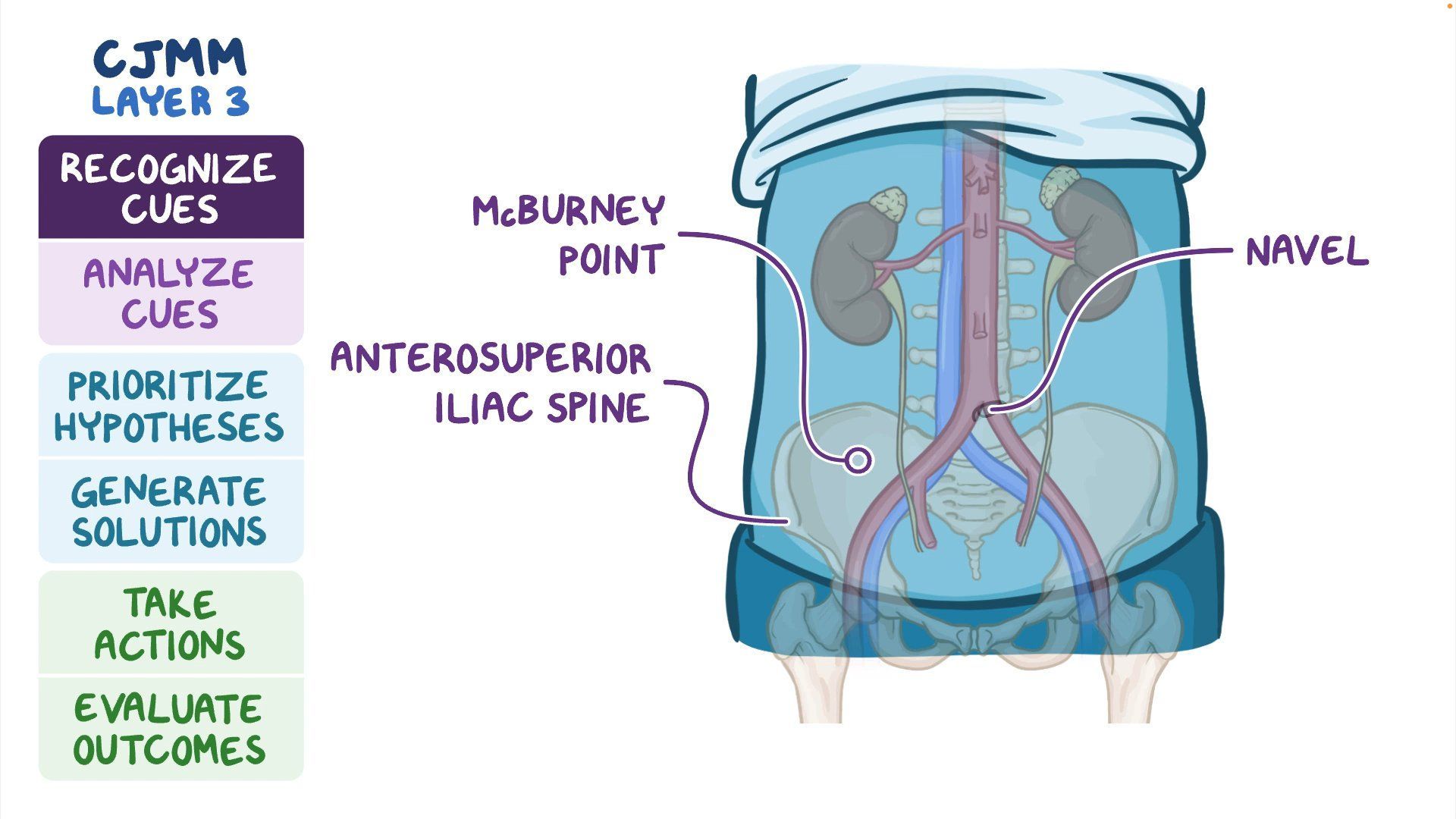 Video: Case study - Pediatric appendicitis: Nursing | Osmosis