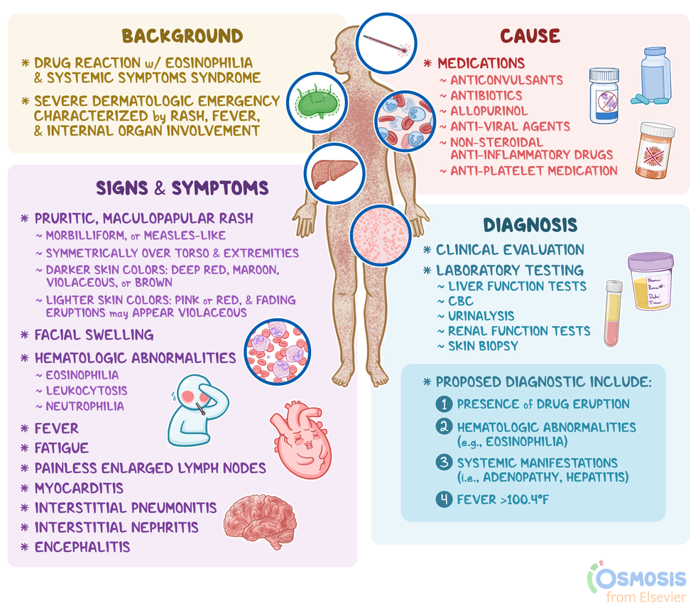 DRESS Syndrome: What Is It, Symptoms, Diagnosis, and More | Osmosis