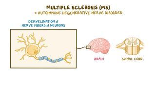 Binocular Diplopia: What Is It, Causes, Diagnosis, and More | Osmosis