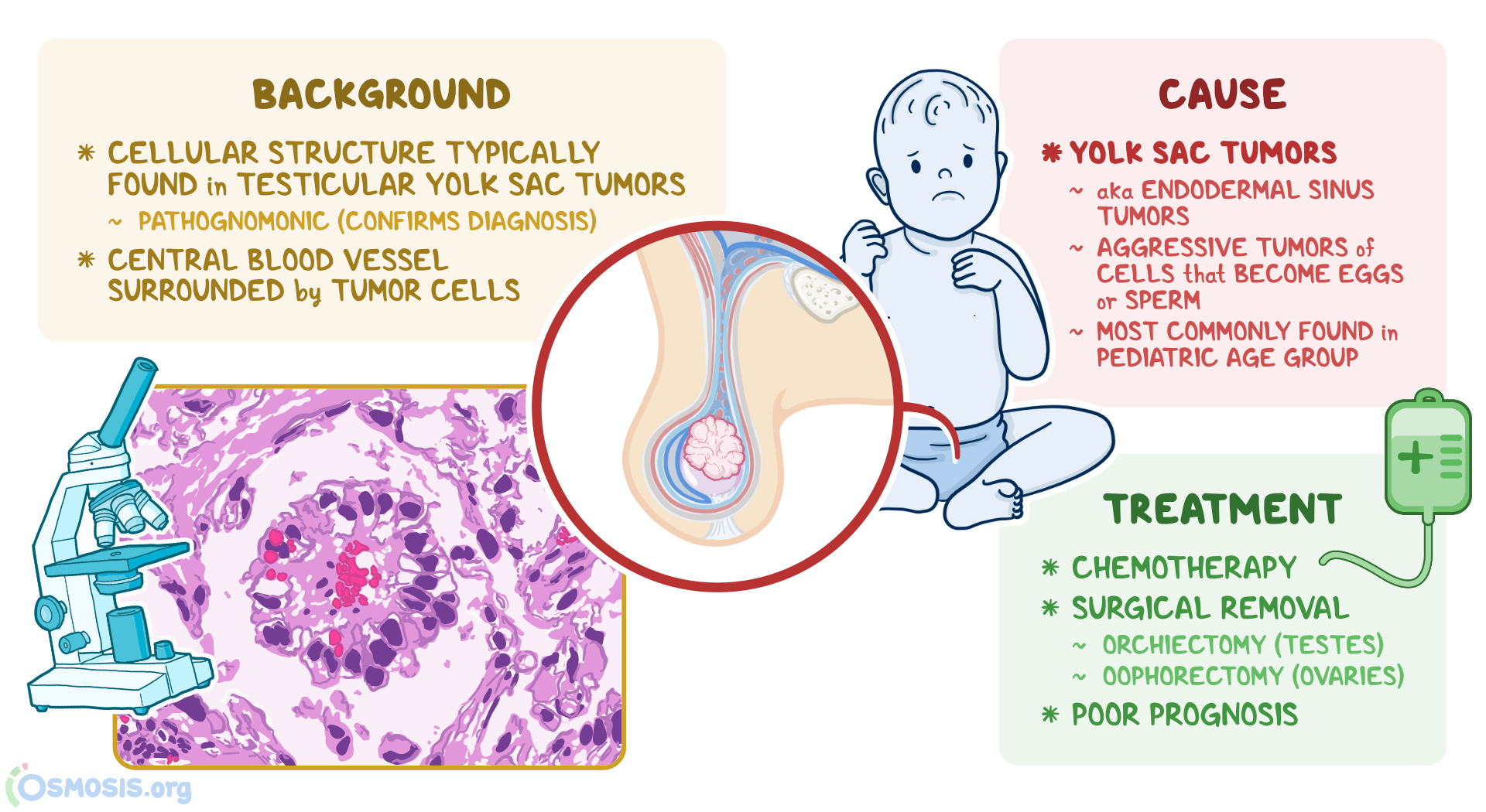 Schiller Duval Bodies: What Are They, Causes, and More | Osmosis