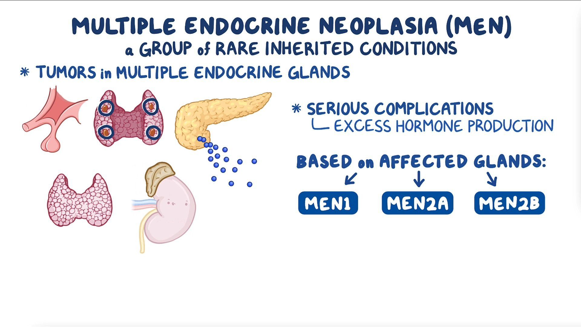 Video: Multiple endocrine neoplasia: Clinical sciences | Osmosis