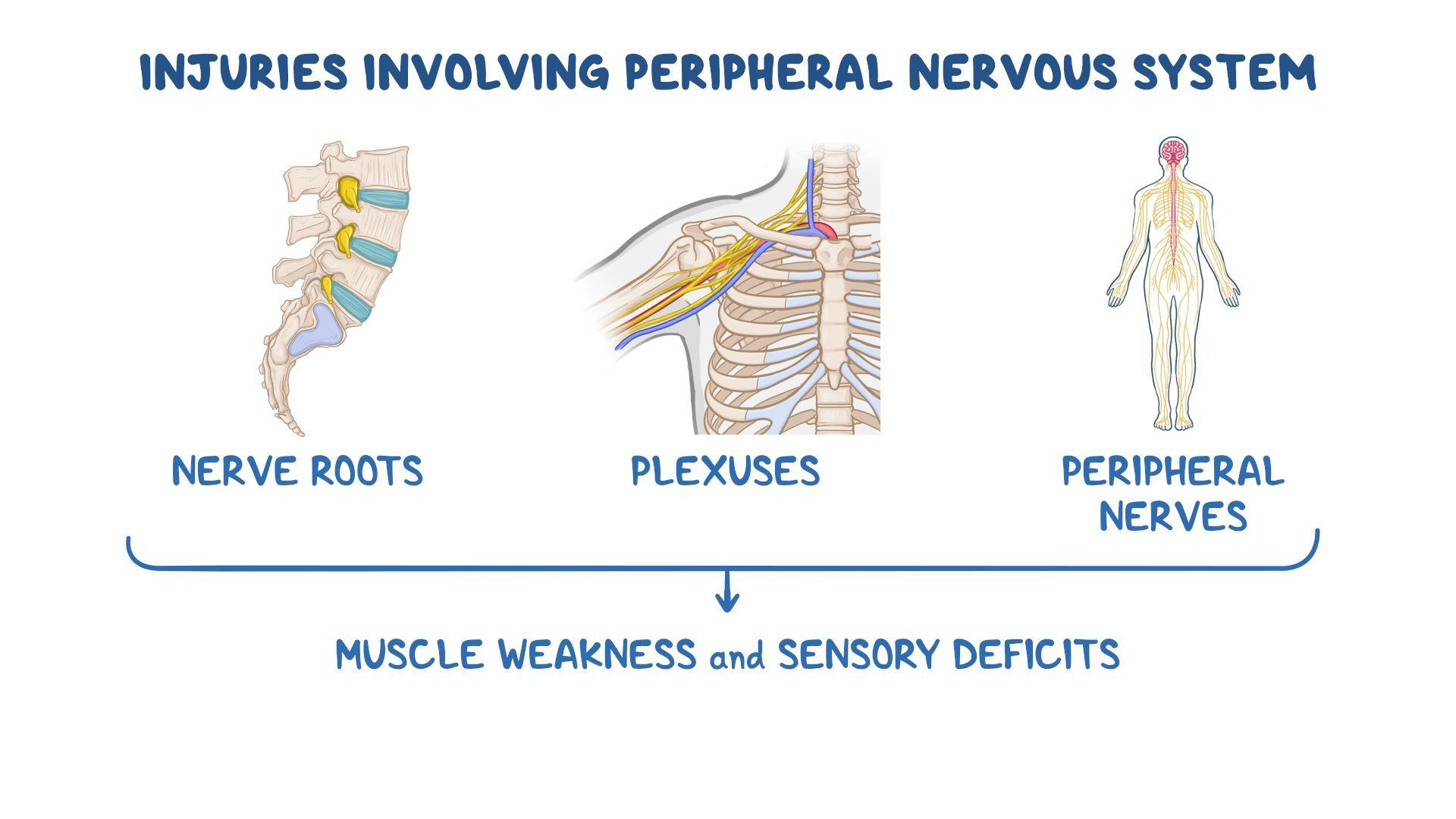Video: Approach to differentiating lesions (nerve root, plexus, and ...