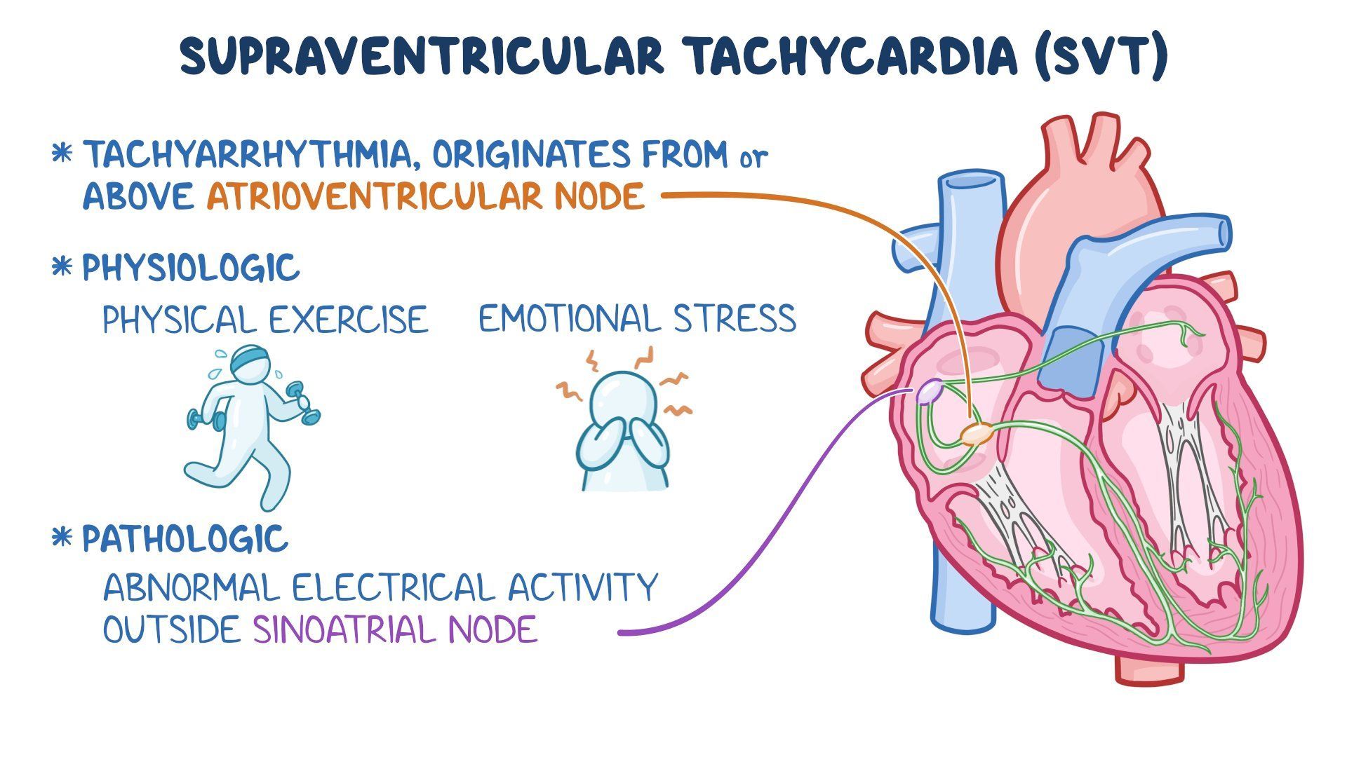 Video: Supraventricular tachycardia: Clinical sciences | Osmosis