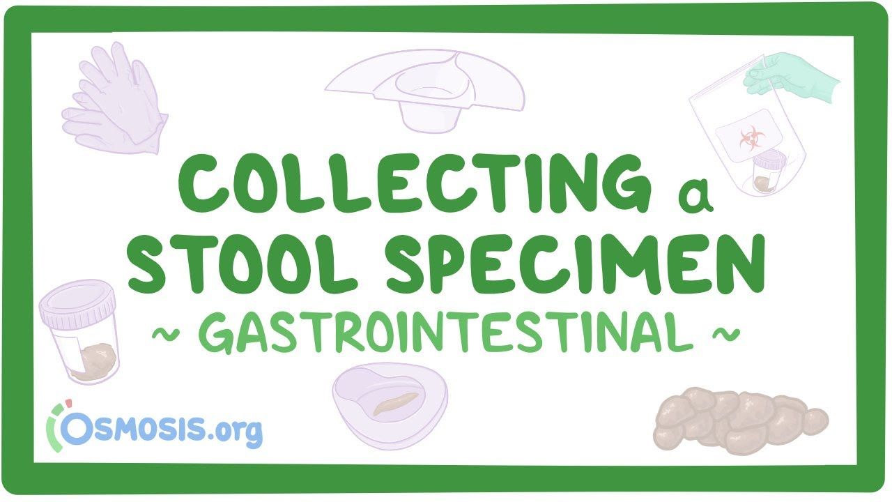 Gastrointestinal: Collecting a stool specimen - Osmosis