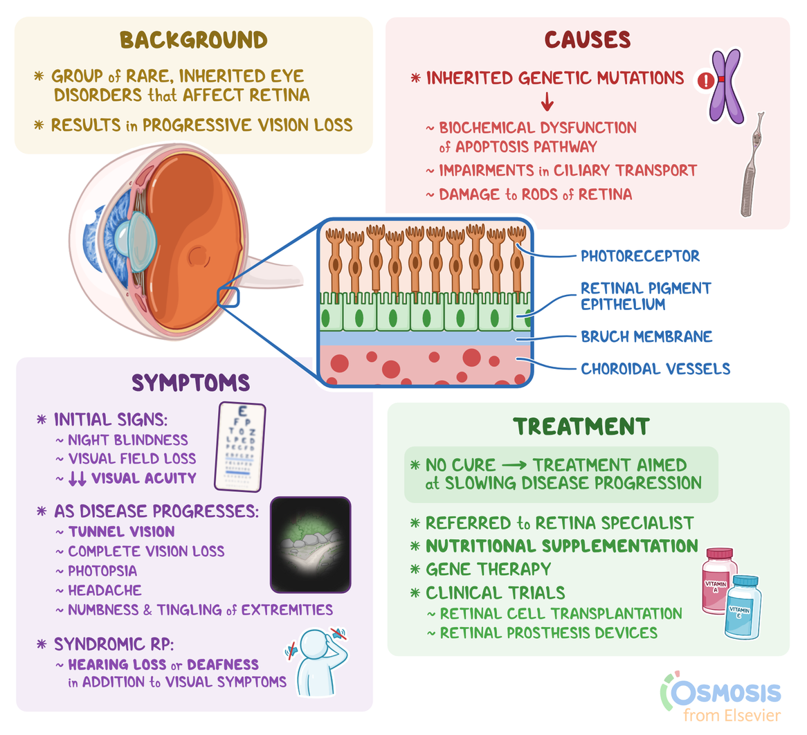 Retinitis Pigmentosa: What It Is, Causes, Symptoms, Treatment | Osmosis