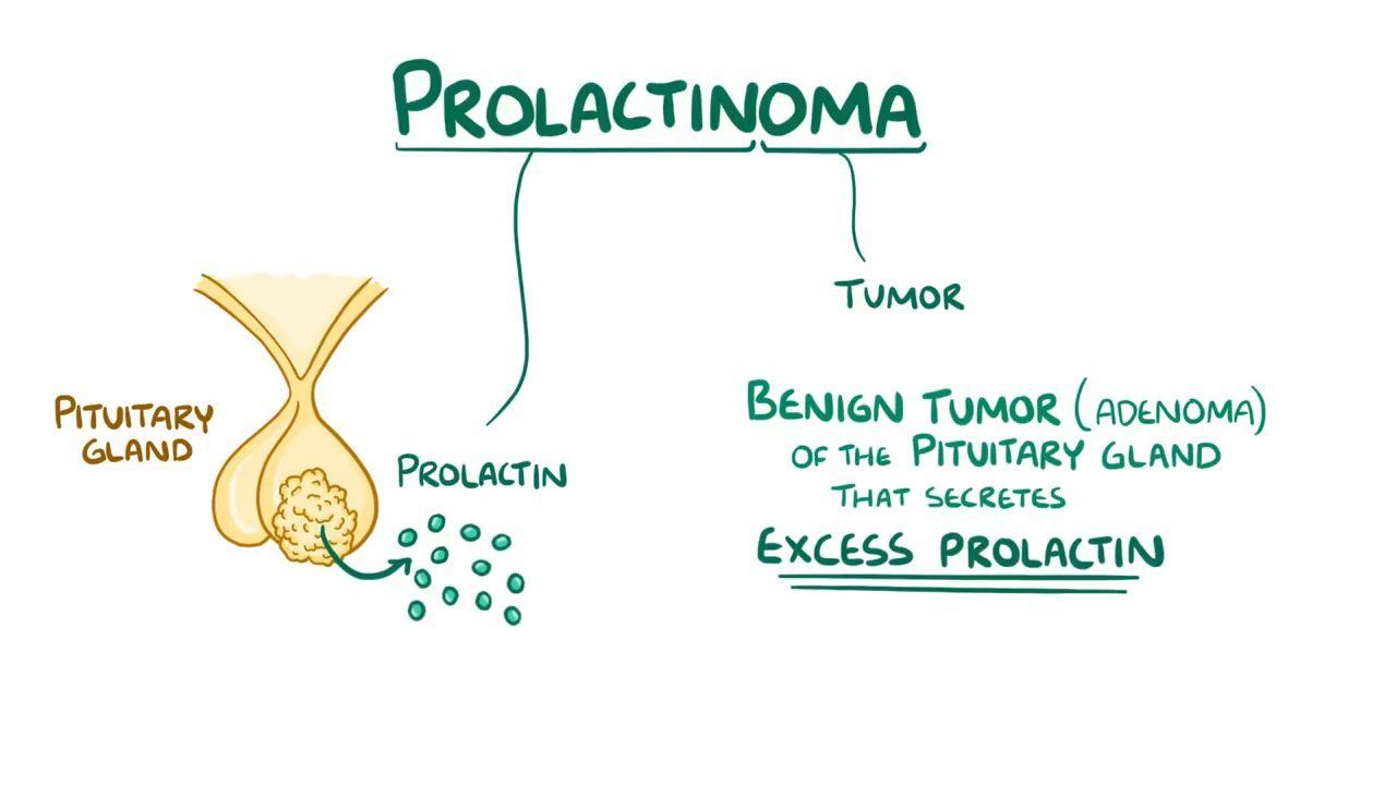 Video: Prolactinoma | Osmosis