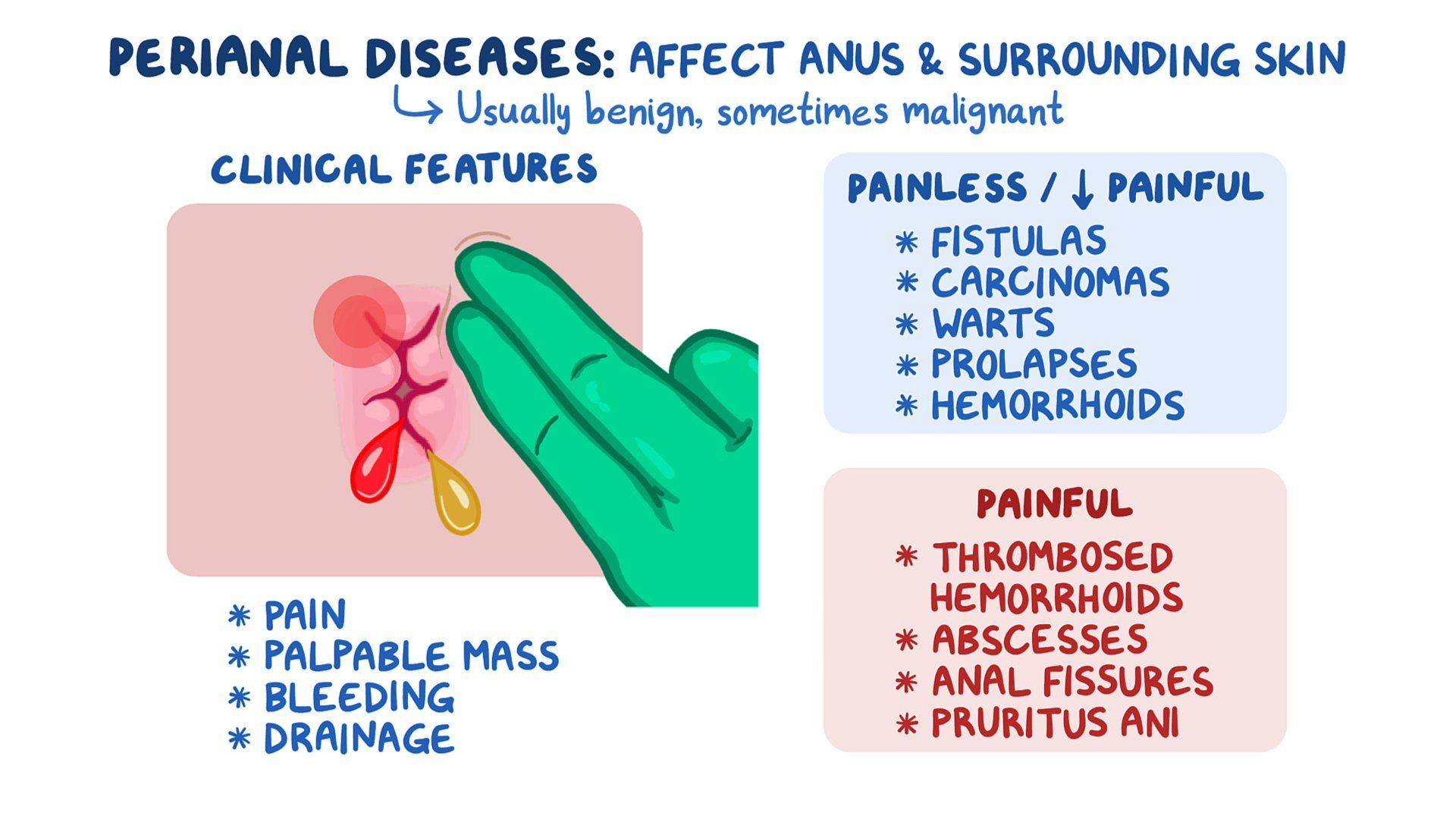 Video: Approach to perianal problems: Clinical sciences | Osmosis