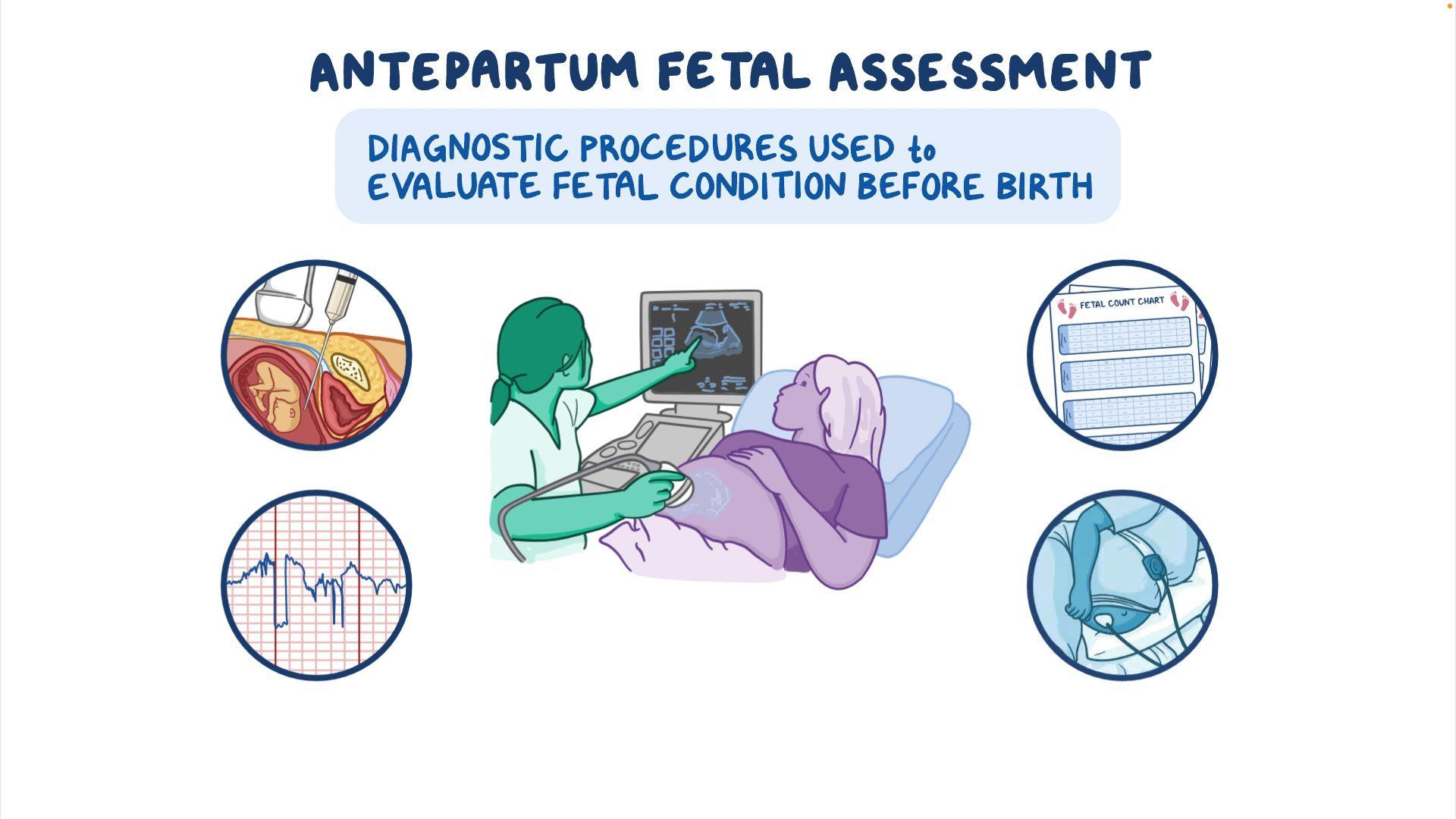 Video Antepartum Assessment Fetus Nursing