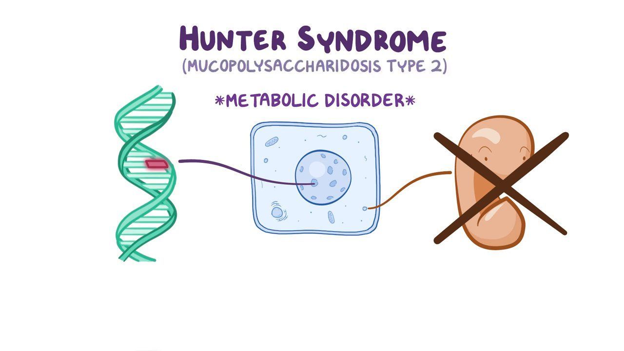 Video: Mucopolysaccharide storage disease type 2 (Hunter syndrome ...