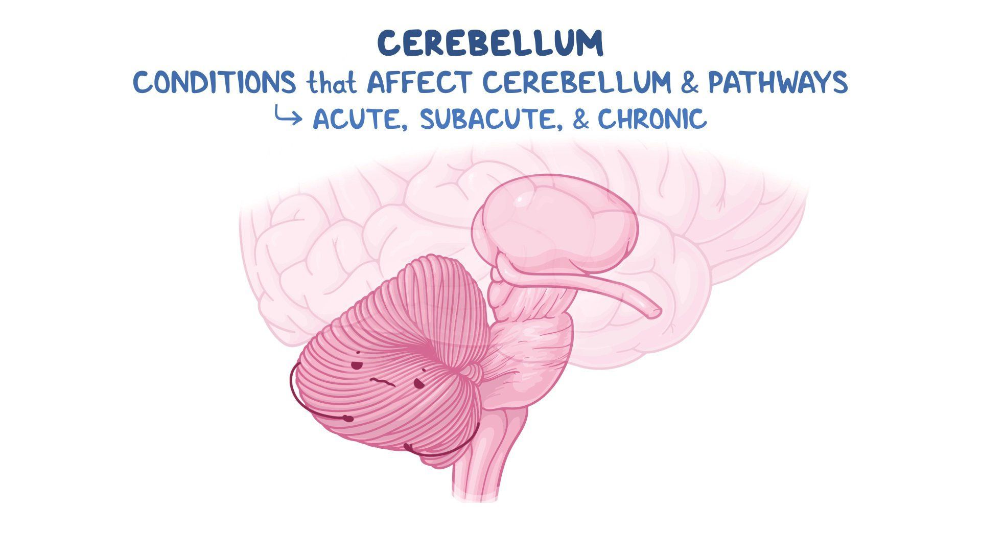 Video: Approach to differentiating lesions (cerebellum): Clinical sciences