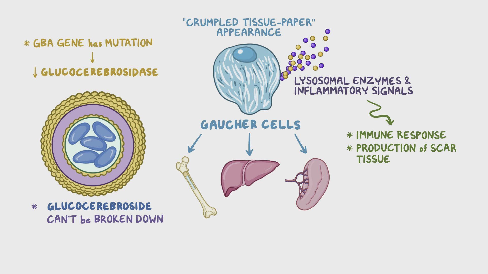 Video: Gaucher disease (NORD): Year of the Zebra | Osmosis