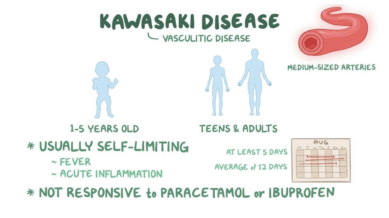 Video Kawasaki Disease Clinical
