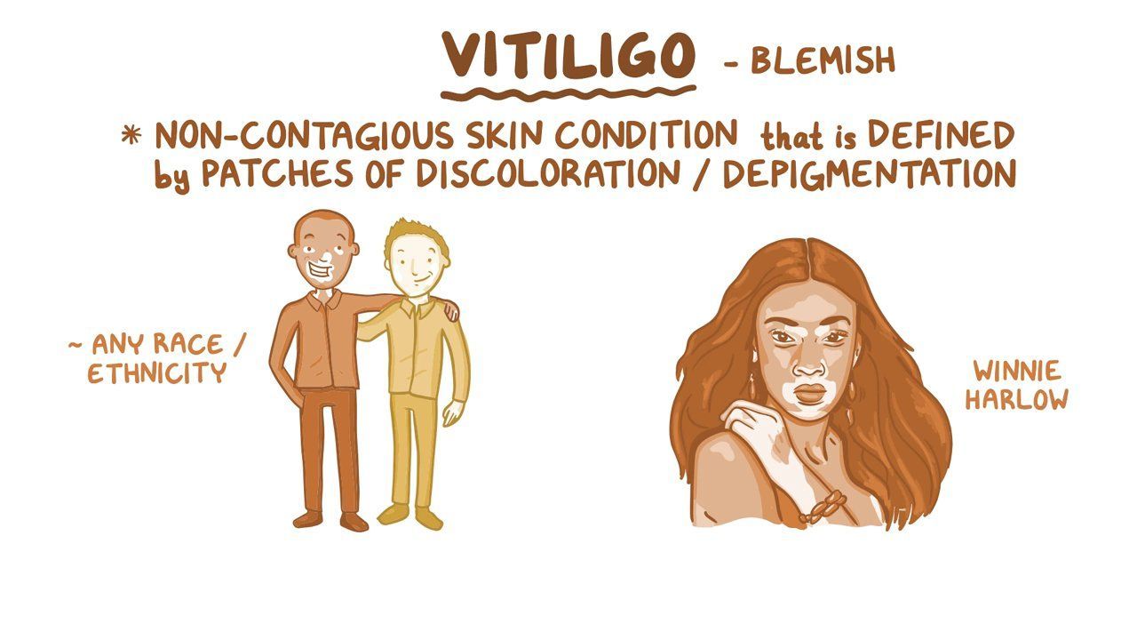 Video: Vitiligo | Osmosis