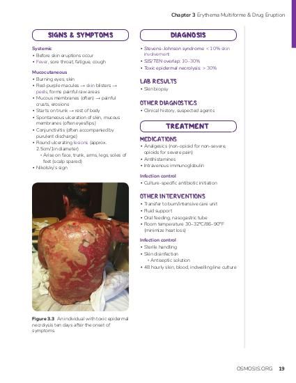 Stevens-Johnson syndrome | Osmosis