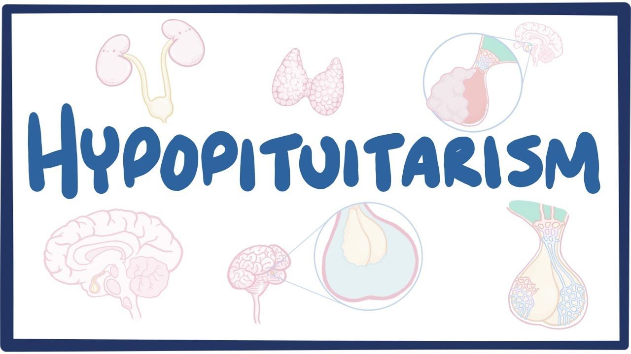 Hypopituitarism - Osmosis