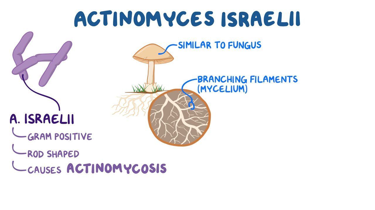 Video: Actinomyces israelii | Osmosis
