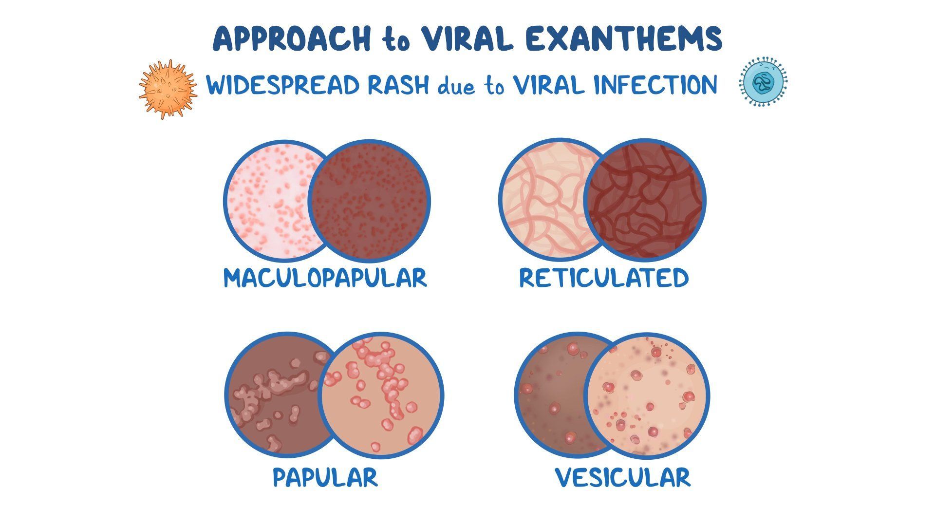 Video Approach To Viral Exanthems pediatrics Clinical Sciences