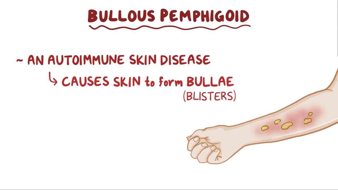 Video: Bullous pemphigoid | Osmosis