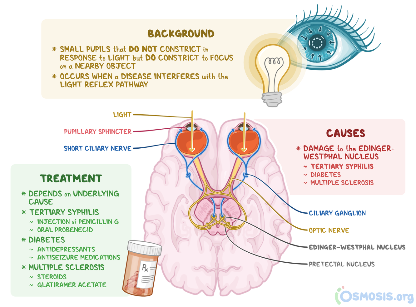 Argyll Robertson Pupil: What Is It, Causes, and More | Osmosis