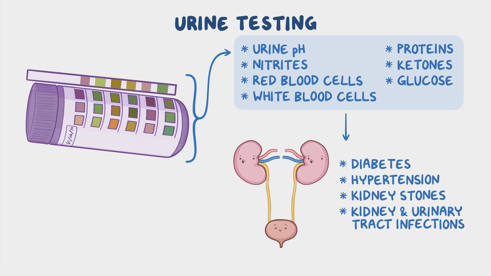 Video: Genitourinary: Performing urine testing | Osmosis