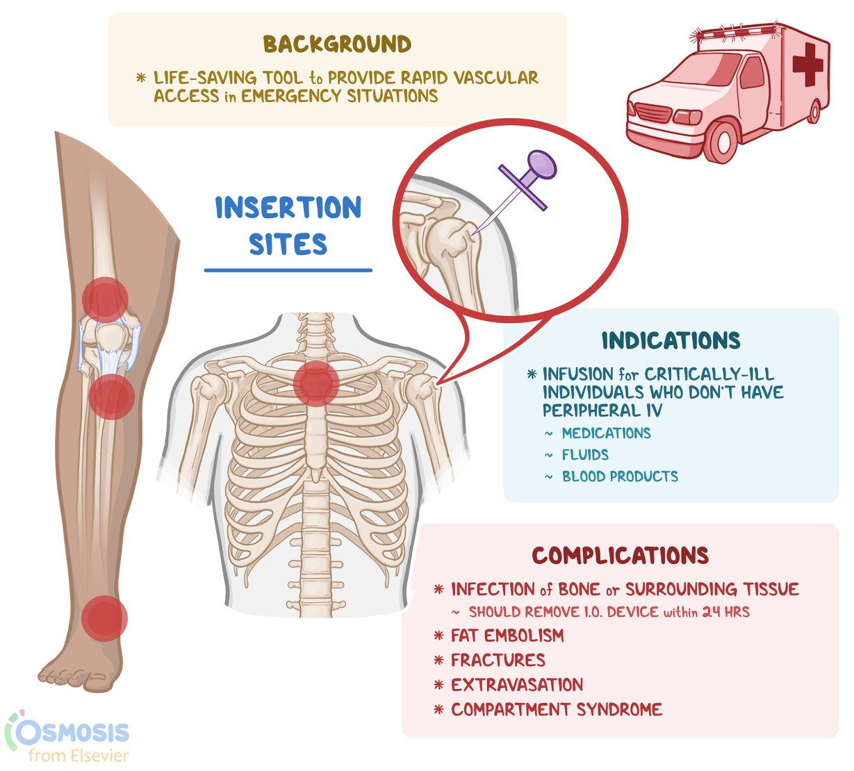 Intraosseous IO Device What Is It Osmosis