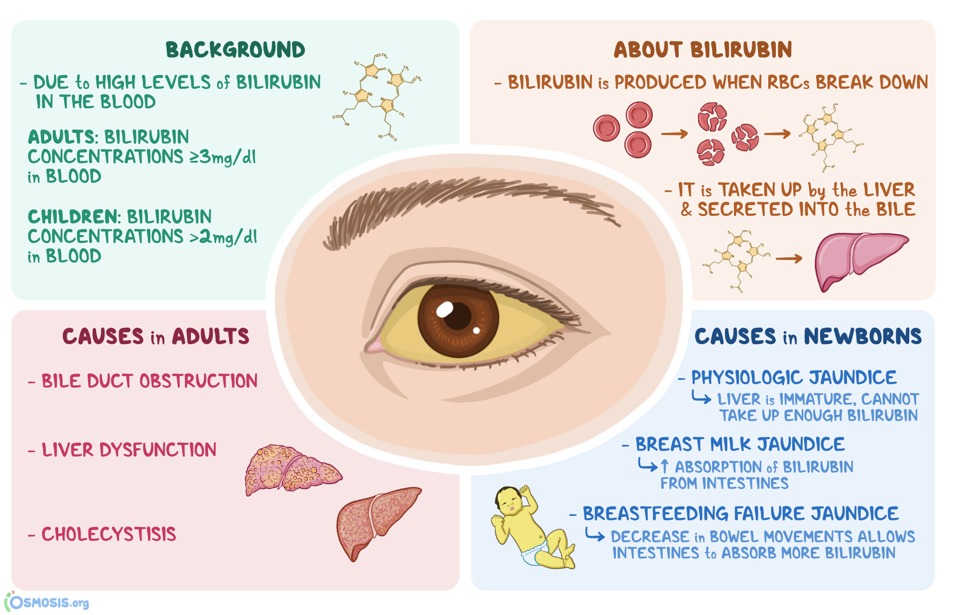 Scleral Icterus Expertpase