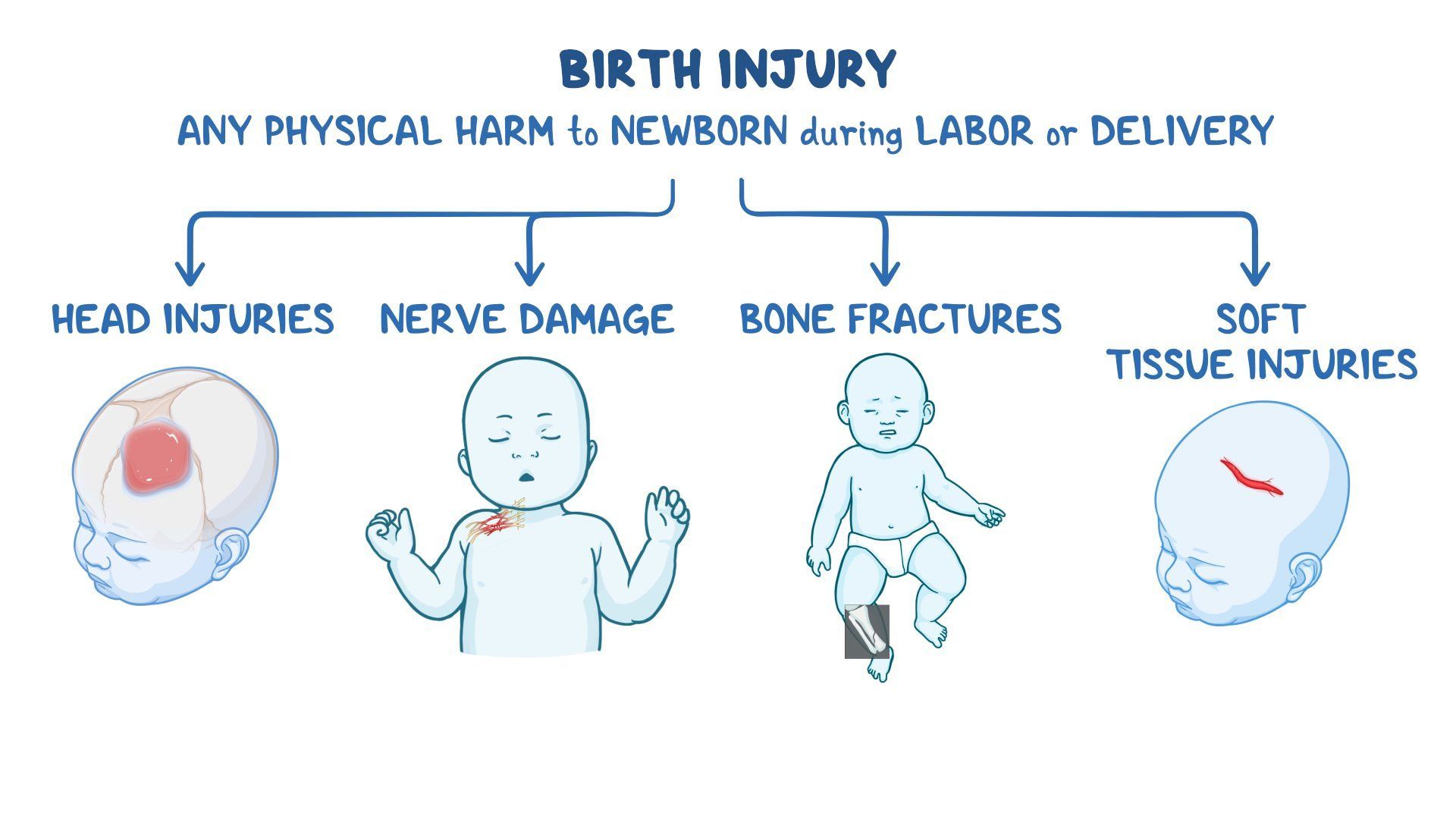 Video: Approach to birth injury (pediatrics): Clinical sciences | Osmosis