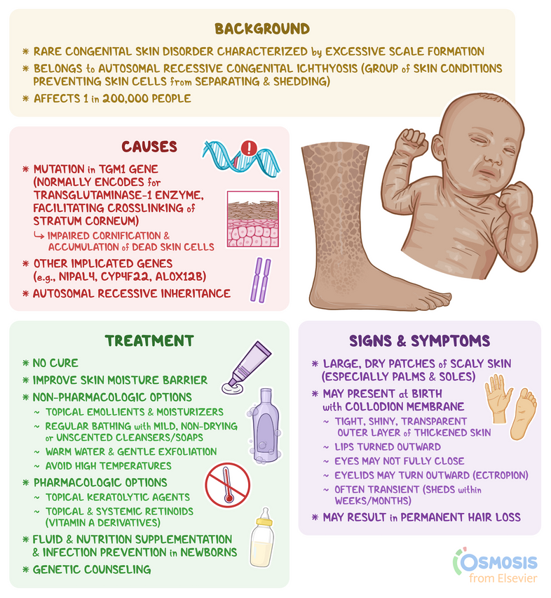 amellar Ichthyosis: What It Is, Causes, Signs and Symptoms, Treatment | Osmosis