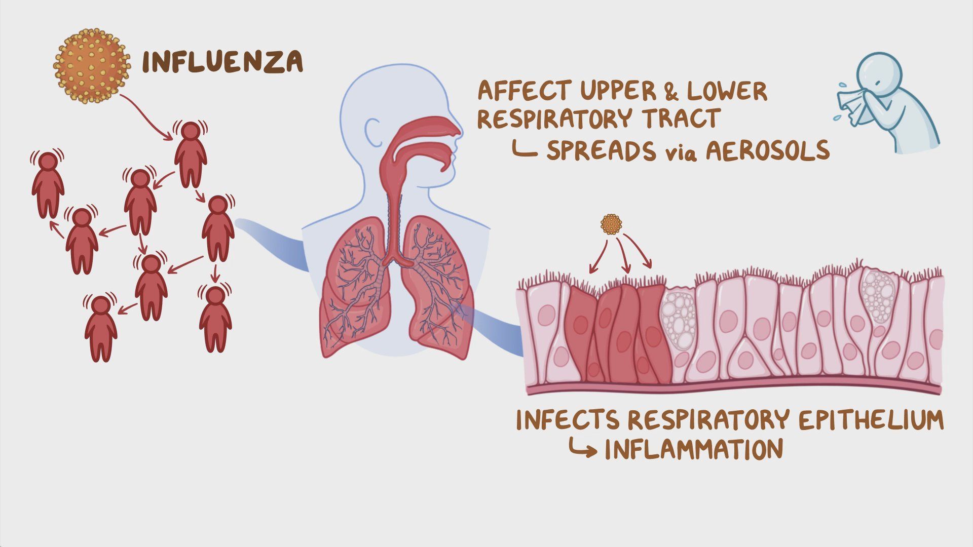 Video: Influenza: Clinical sciences | Osmosis