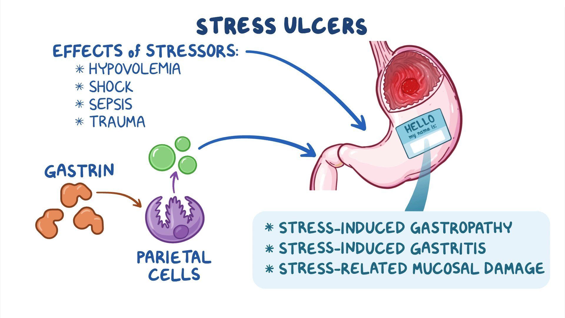 Video: Stress ulcers: Clinical sciences | Osmosis