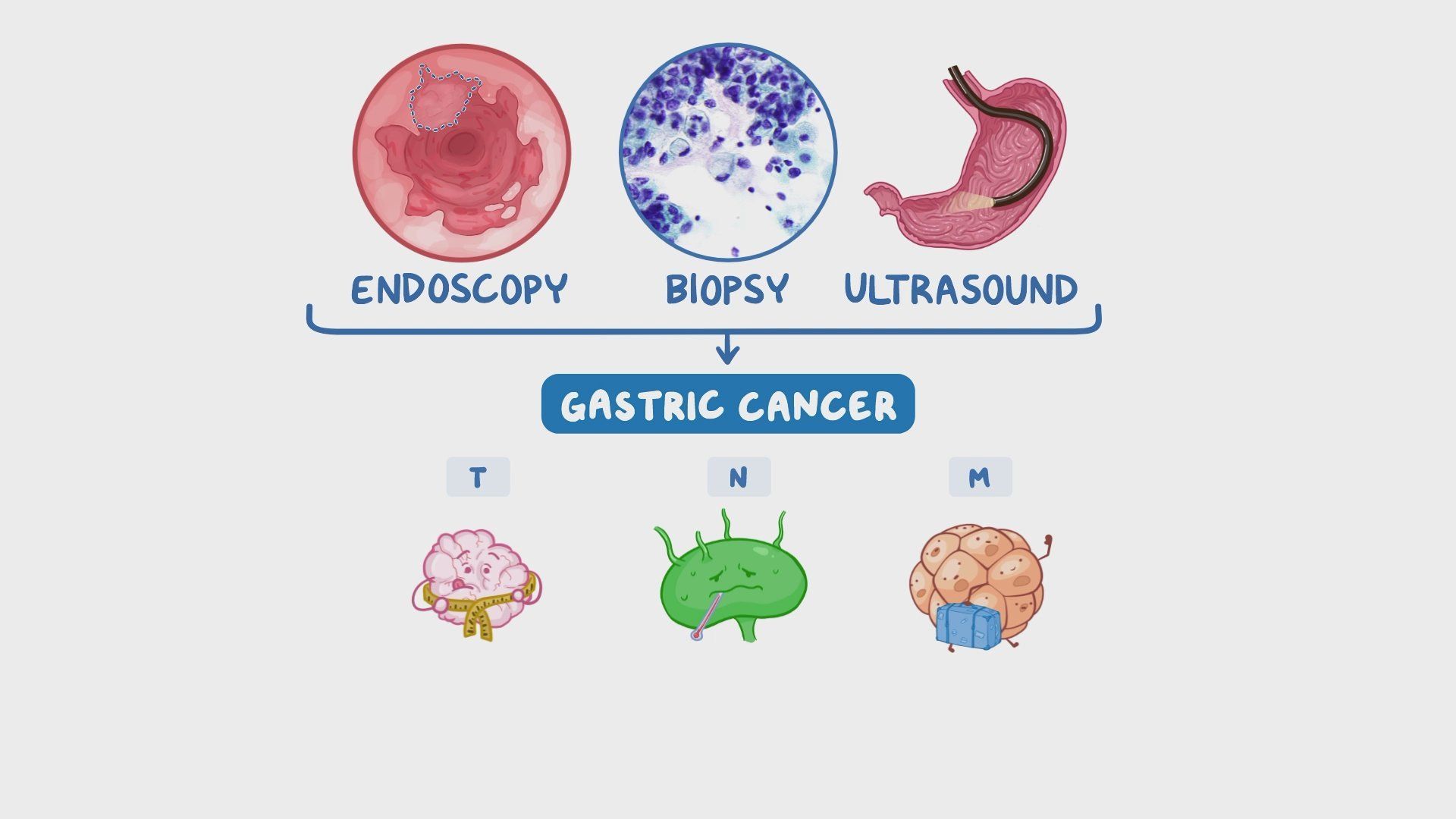 Video: Gastric cancer: Clinical sciences