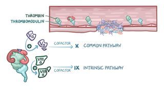 Hypercoagulable disorders Notes: Diagrams & Illustrations | Osmosis
