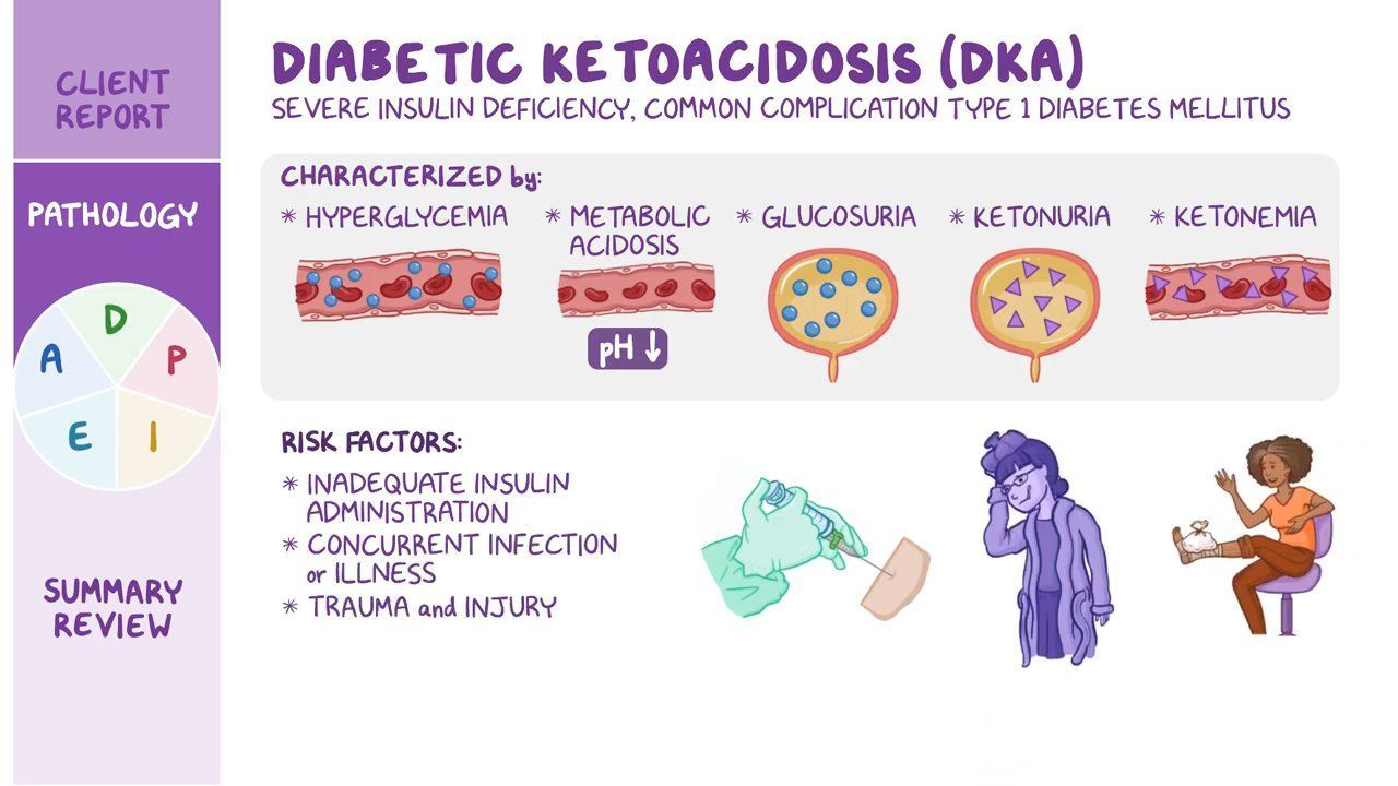 Video Diabetic Ketoacidosis DKA Nursing Process ADPIE 