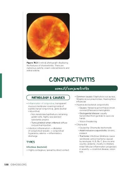Conjunctivitis | Osmosis
