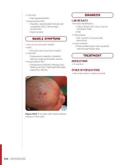 Neonatal conjunctivitis - Osmosis