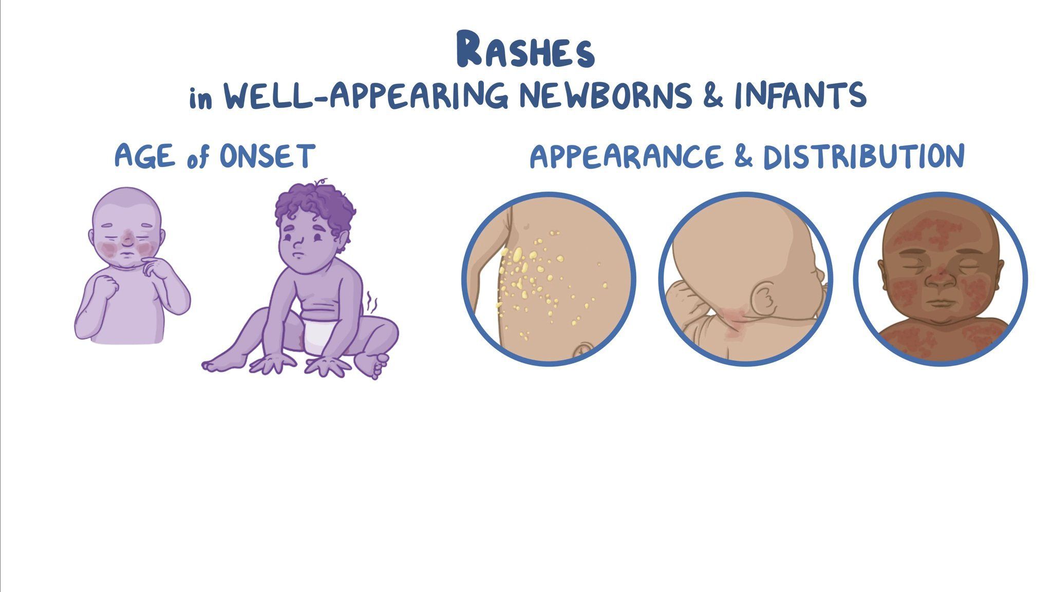 Video: Approach to a rash in the well newborn and infant: Clinical ...