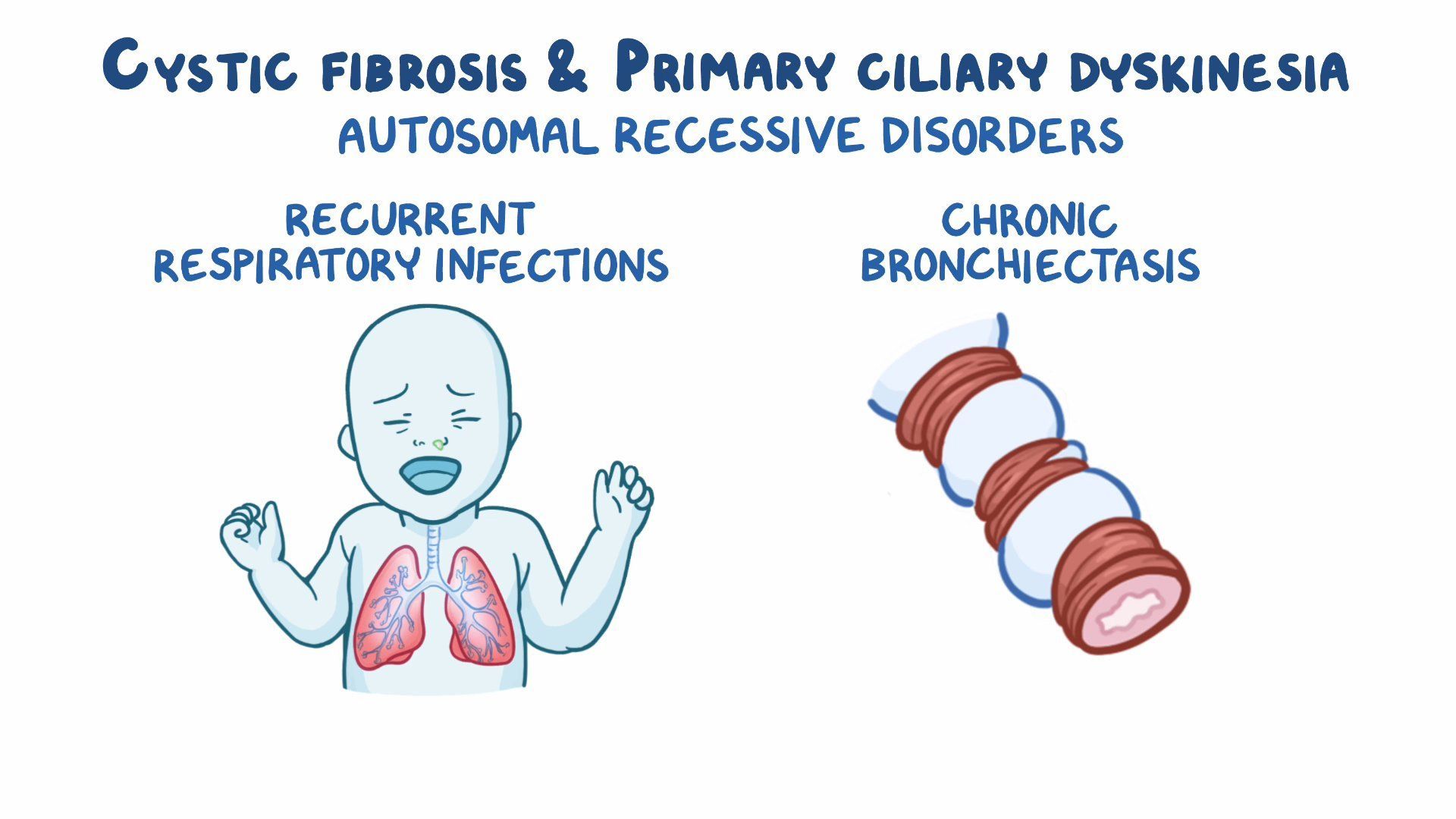 Video: Cystic fibrosis and primary ciliary dyskinesia: Clinical sciences | Osmosis
