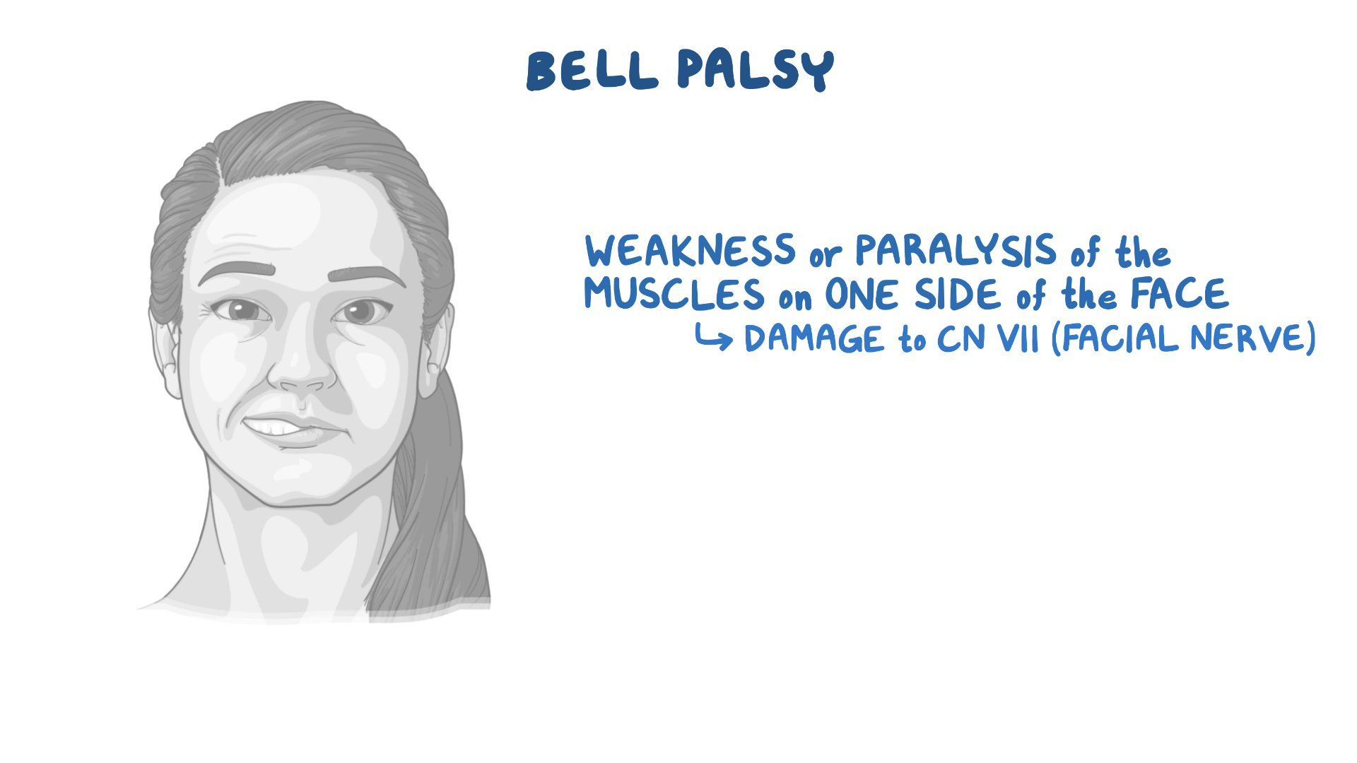 Video: Bell palsy: Nursing