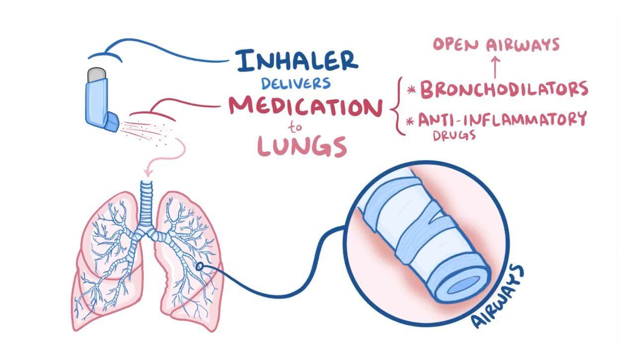 Video: Using an inhaler: Information for patients and families | Osmosis