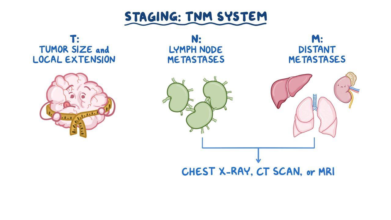 Video: Vulvar cancer: Clinical